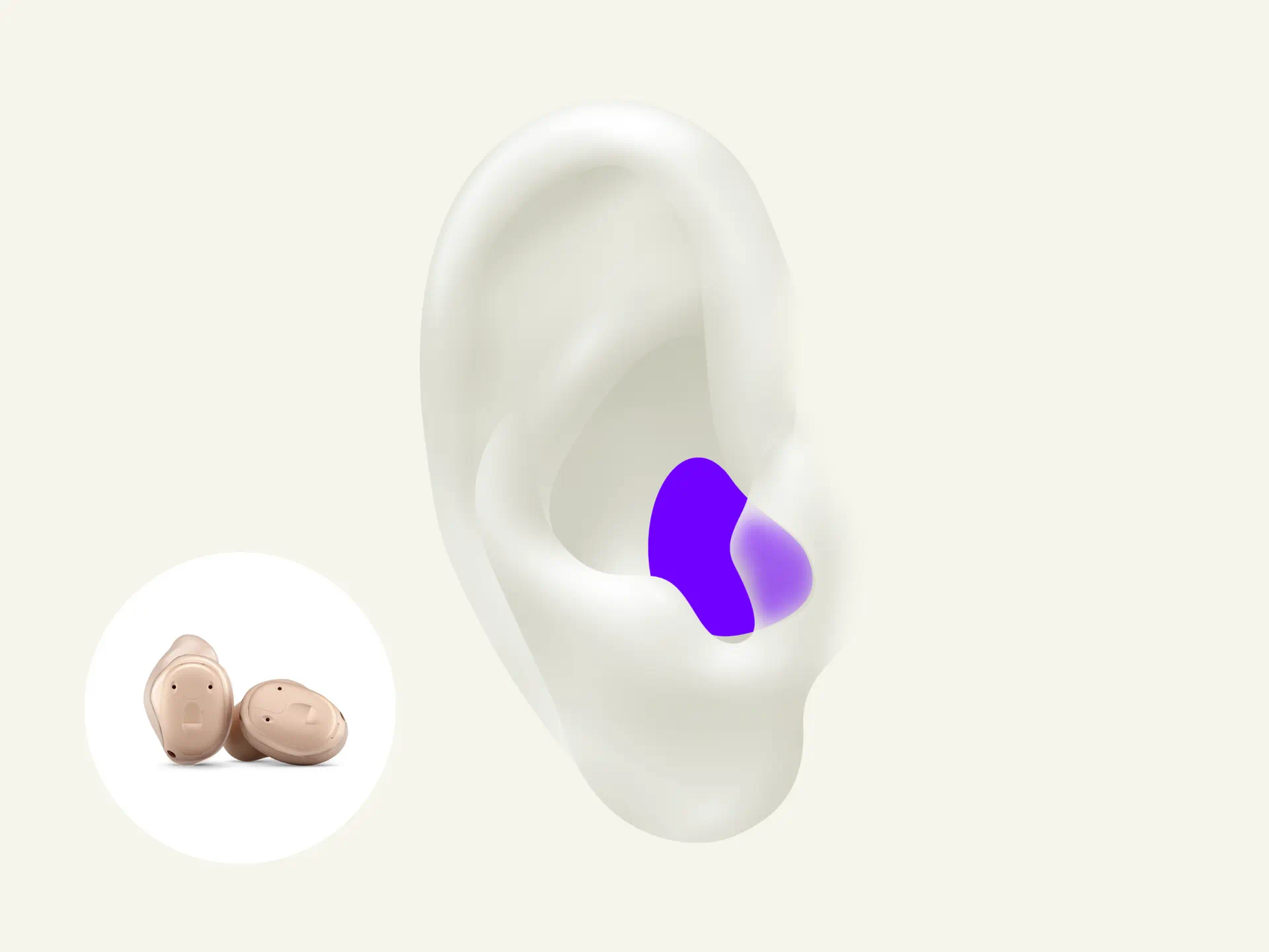 In the ear (ITE) hearing aids - Styles, brands & benefits