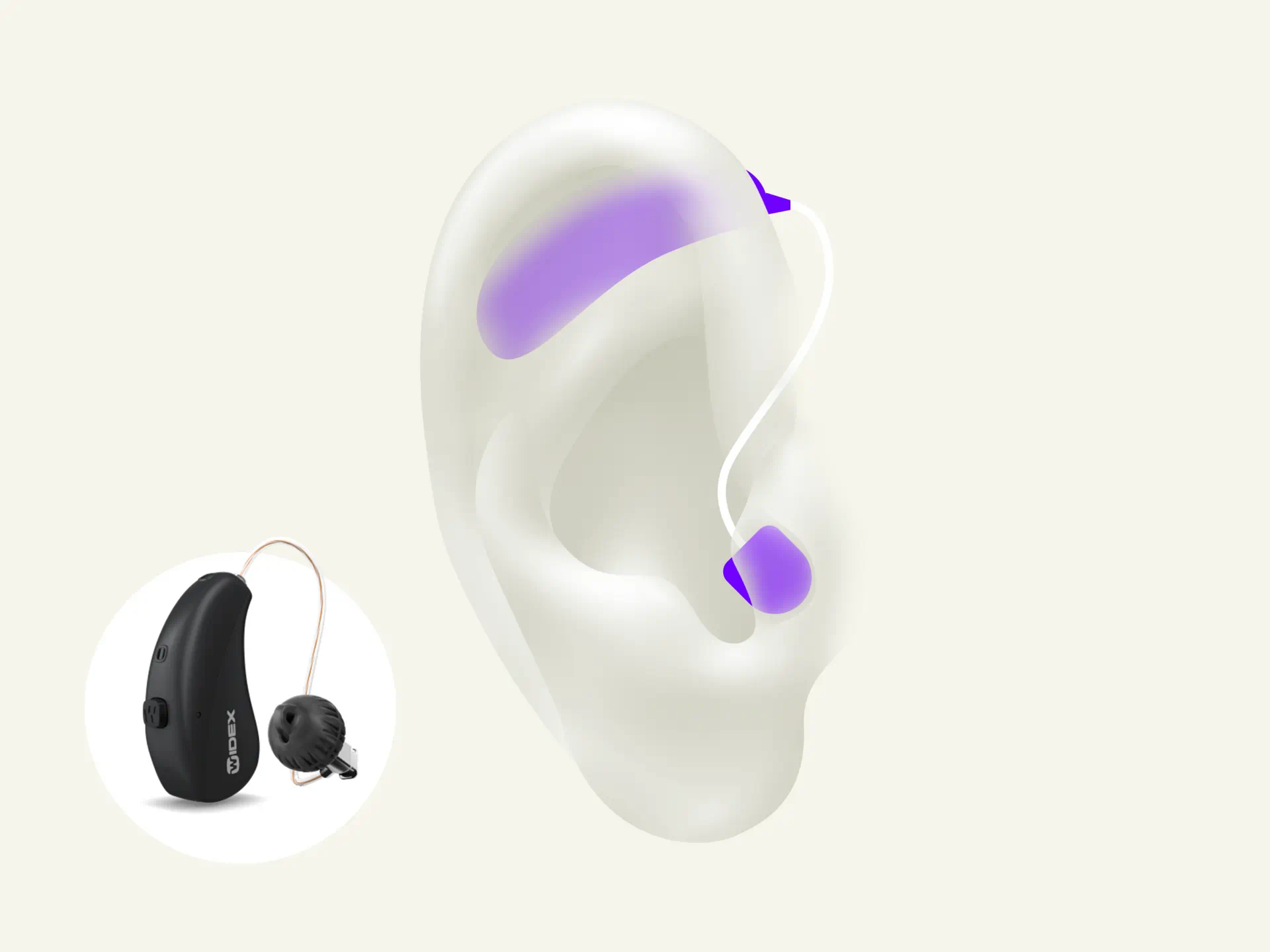 Best Receiver-in-Canal (RIC) Hearing Aids | HearUSA